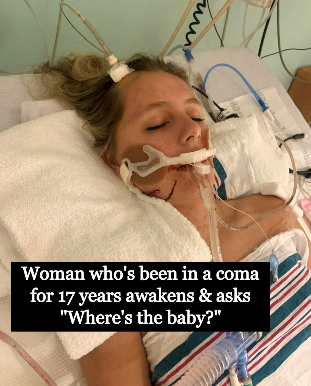 Woman who’s been in a coma for 17 years awakens & asks “Where’s the ...